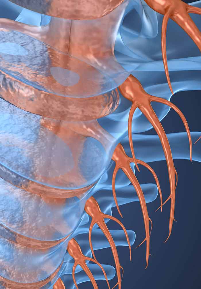 Lumbar Interspinous Devices: Indications, Surgical Aspects, Clinical ...