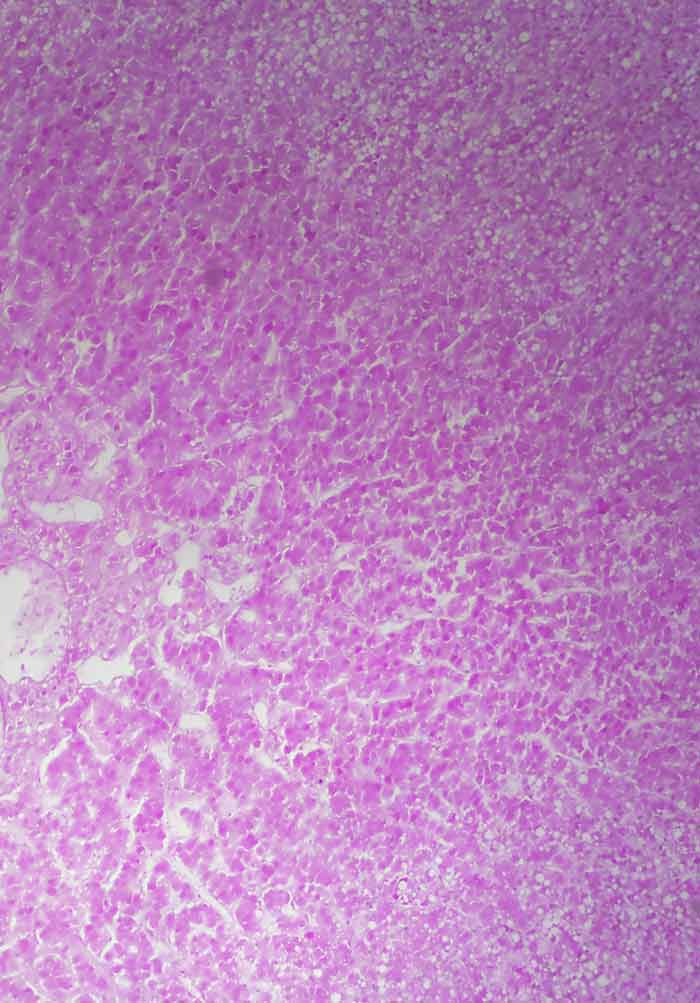 Distribution of Cortisol in Human Plasma in vitro: Equilibrium ...