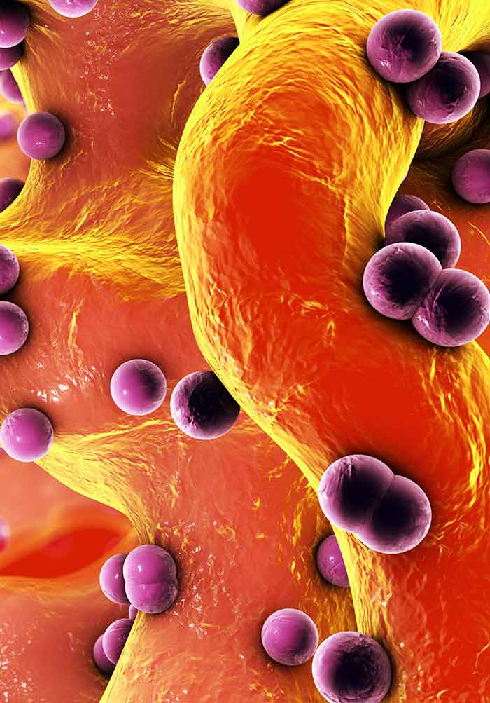 Sepsis - Diagnosis, Treatment, and Clinical Challenges | IntechOpen